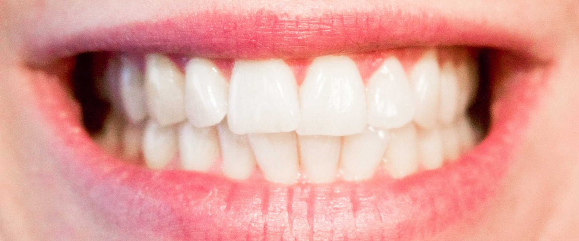 How do you know if your teeth are in good health?